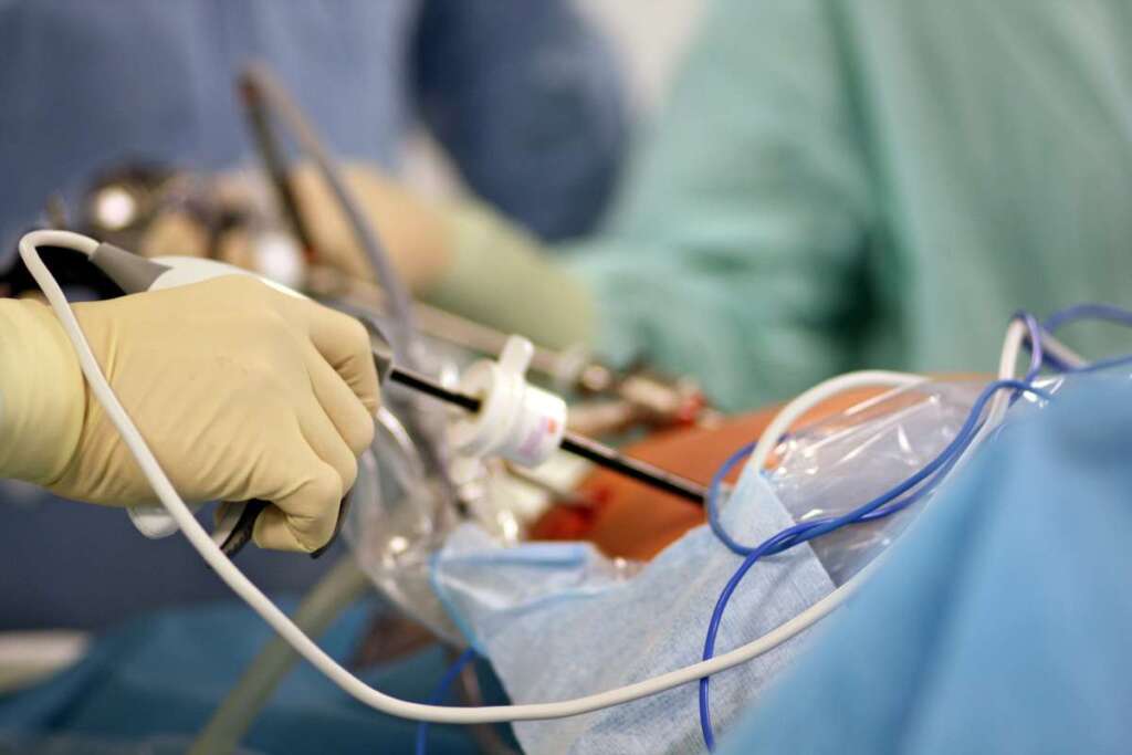 Endometrioz Nədir? Yaranma Səbəbləri və Müalicəsi | Dr.Xanım